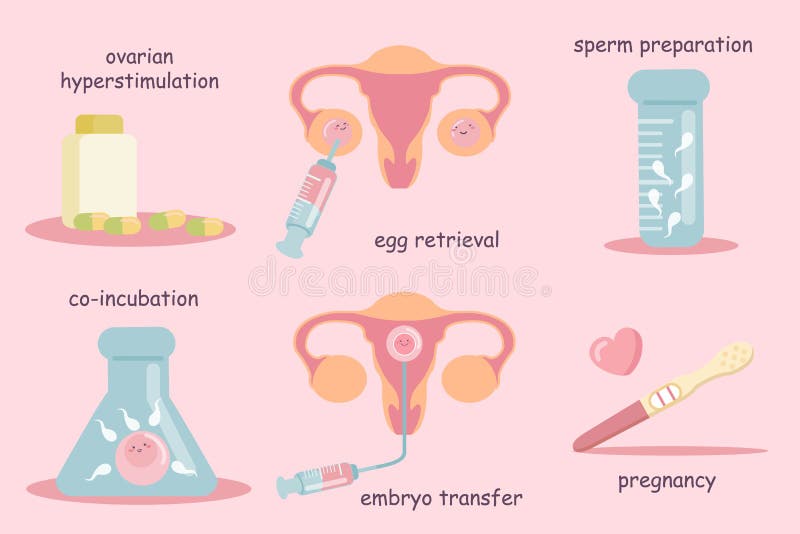 IVF concept stock vector. Illustration of process, medical - 65474925 IVF concept stock vector. Illustration of process, medical - 65474925