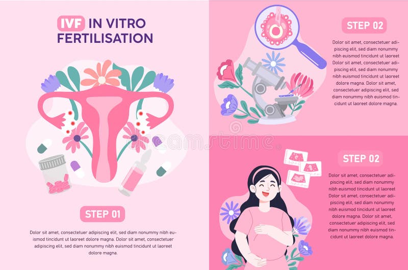 Ivf Treatment Steps With In Vitro Fertilization Concept Vector Illustration Stock Illustration