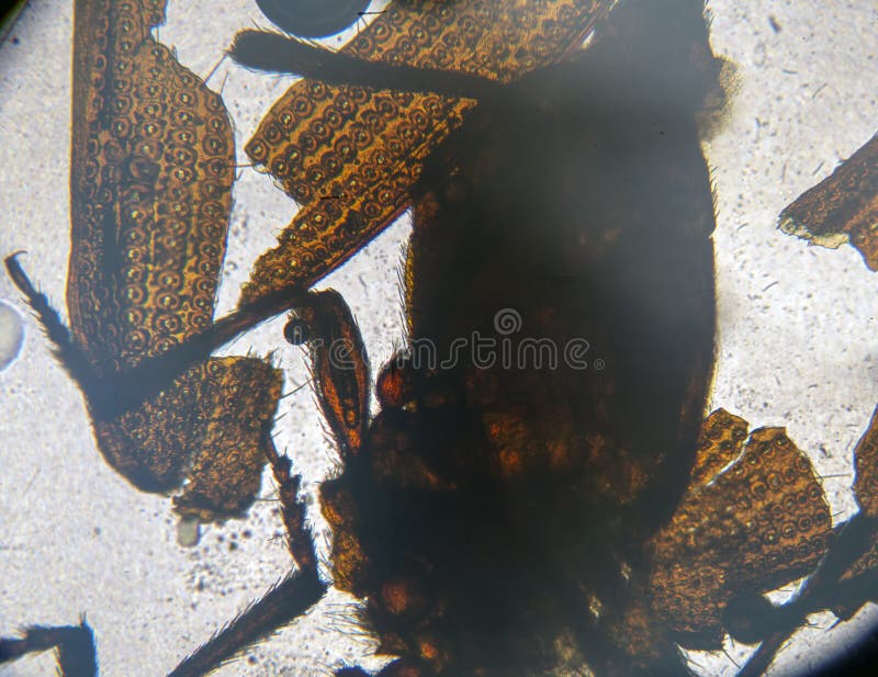 Microscope - Tick (Rhipicephalus Sanguineus) Stock Photo - Image of ...