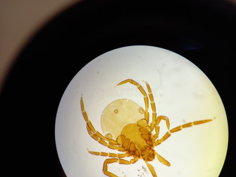Ixodid Tick Under a Microscope. Stock Photo - Image of encephalitis ...