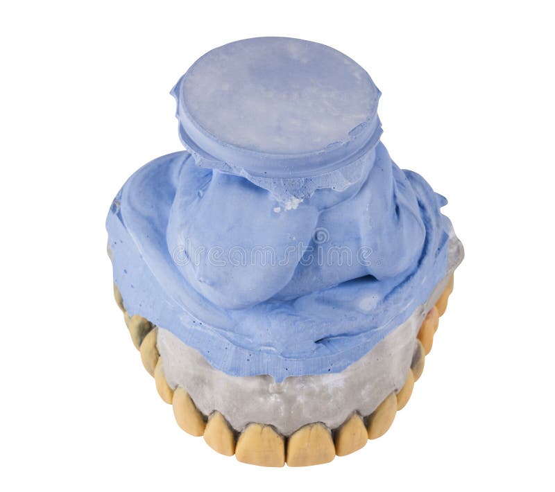 Jaw gypsum impression stock image. Image of view, gypsum - 128244745