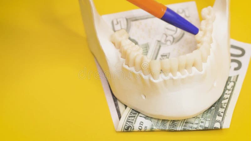 Jaw of a Human with Teeth and Banknotes of Money,dentistry Implantation ...
