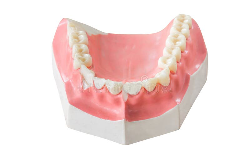 Jaw model stock photo. Image of dentist, closeup, doctor - 80522392