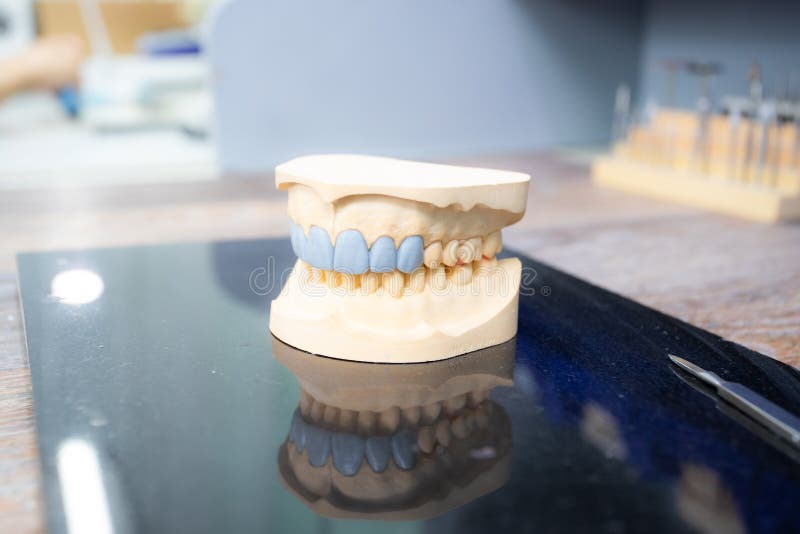 Jaw Model on the Table in the Dental Clinic. Stock Image - Image of ...