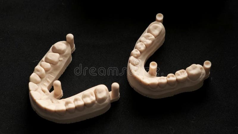 Jaws with Teeth Printed on a 3D Printer. Jaw Model Created Using ...