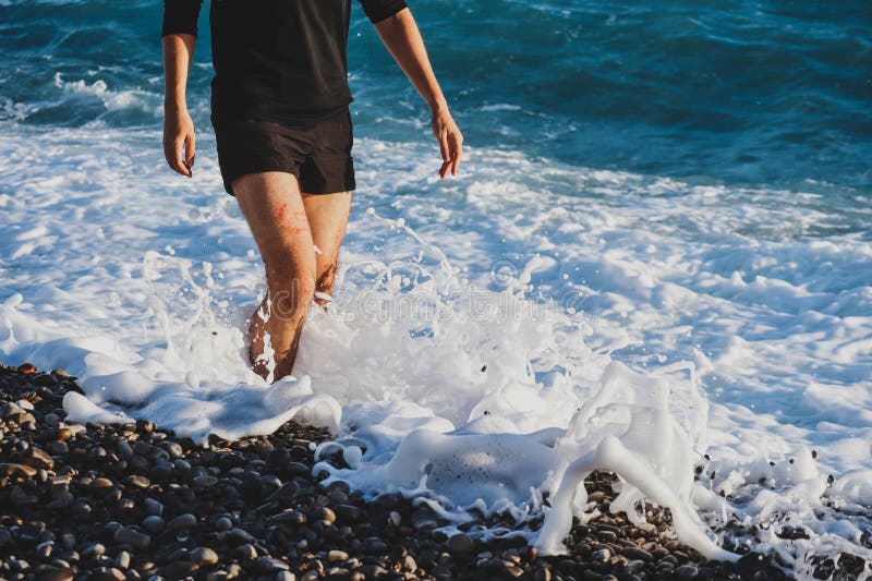 A Jellyfish Sting Burn on a Man S Leg Stock Image - Image of problem ...