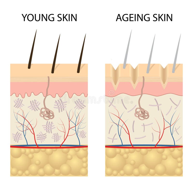 Jeune Peau Saine Et Comparaison Plus Ancienne De Peau Illustration de Vecteur - Illustration du ...