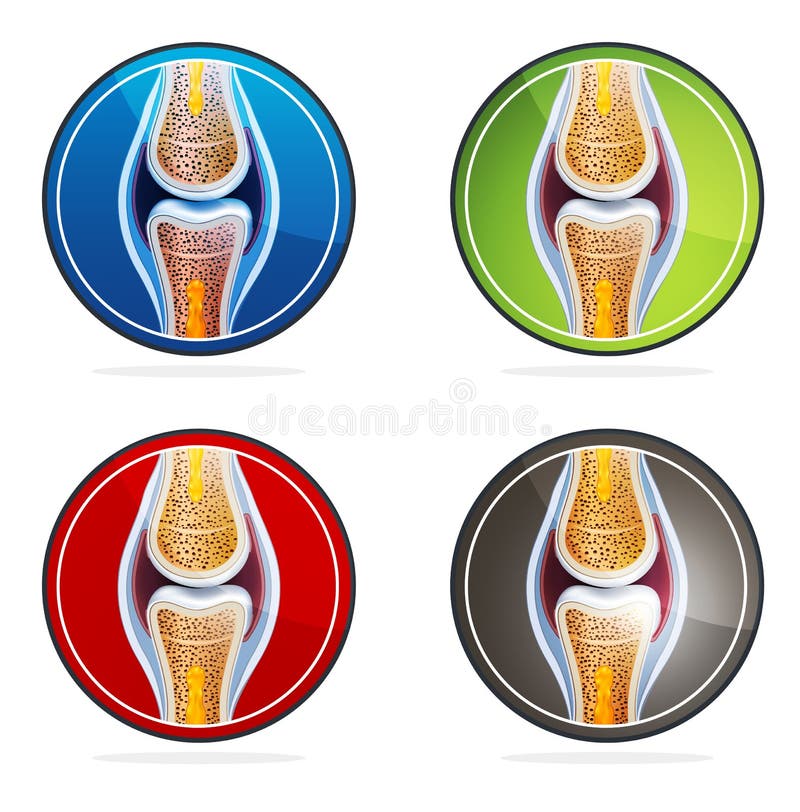 Normal Synovial Joint Anatomy Stock Vector - Illustration of graphic ...