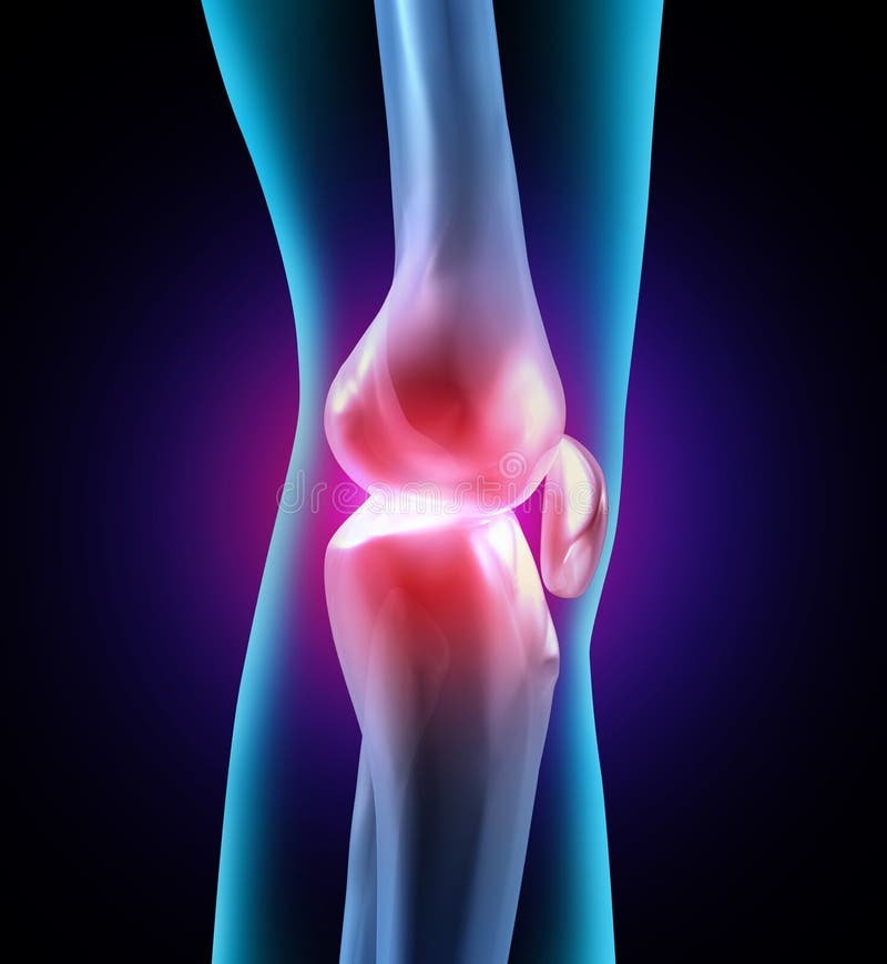 Joint Discomfort stock illustration. Illustration of rheumatism - 24092708