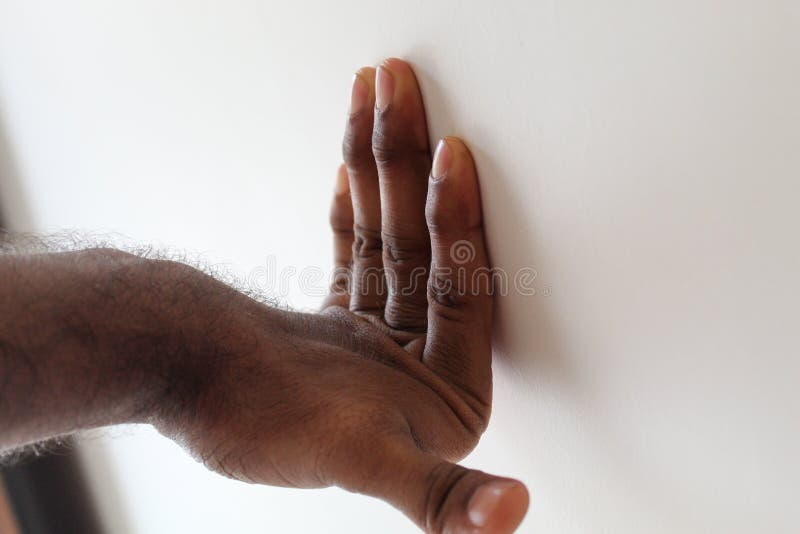 Hypermobility Syndrome of Fingers in a Young Man Stock Photo - Image of ...