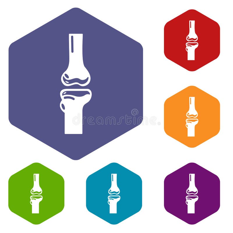 Joint Inflammation Icon, Simple Style. Stock Vector - Illustration of ...