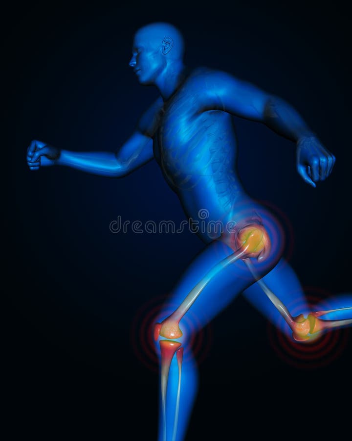 Back pain management stock illustration. Illustration of medical - 36232302