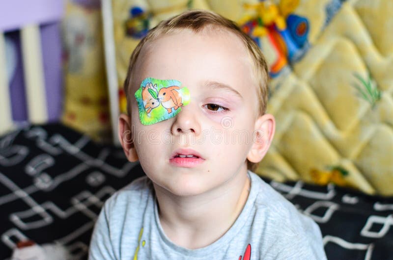 Jongen met Ooglap stock foto. Image of ezelig, correctie - 63123134