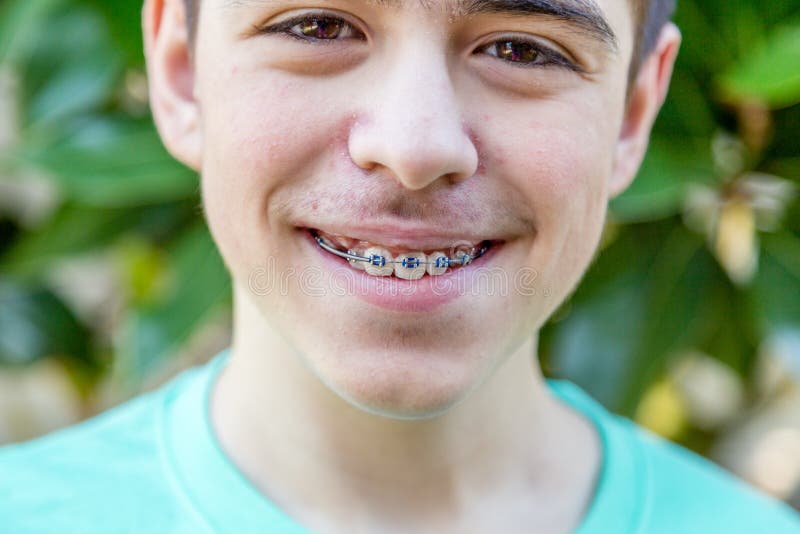 Jongen Met Pukkels, Dermatitis En Steunen Stock Afbeelding - Image of ...