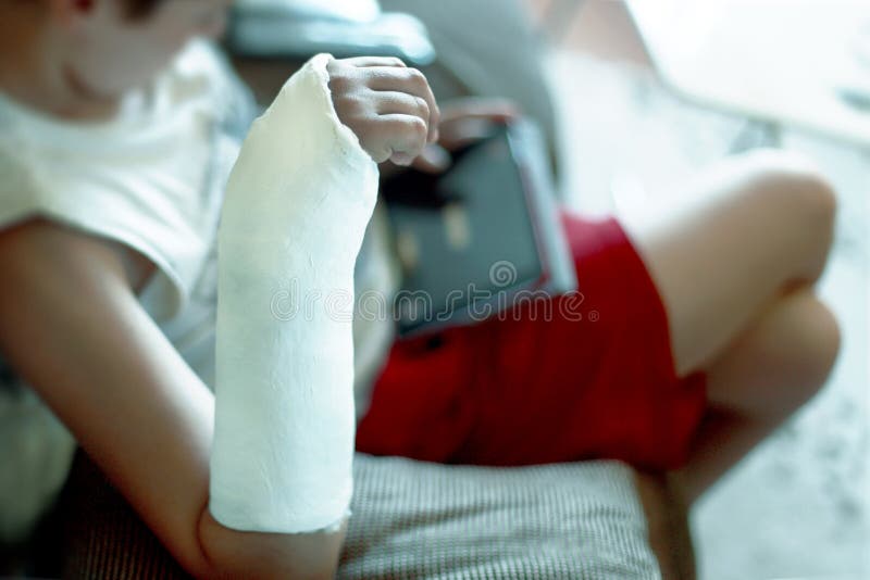 Junge Mit Dem Gebrochenen Arm Stockbild - Bild von finger, verletzt ...