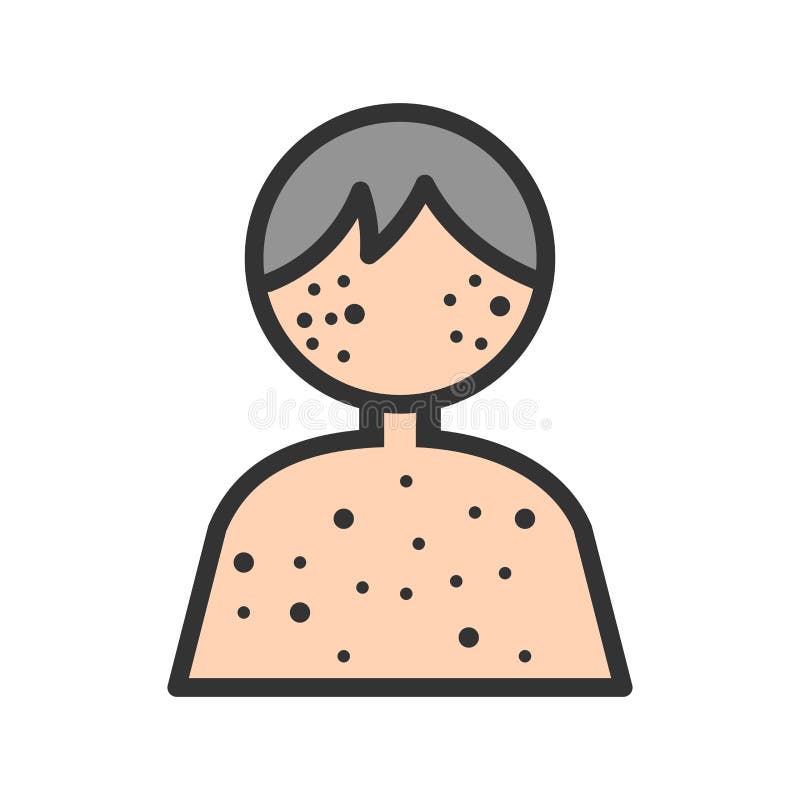 Junge mit Masern vektor abbildung. Illustration von vektor - 79025881