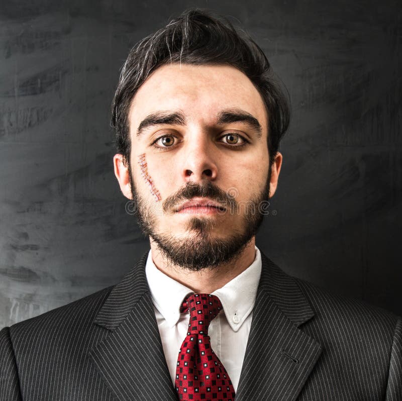 Scarface Ein Junger Mann Mit Einer Großen Narbe Auf Seinem Gesicht ...