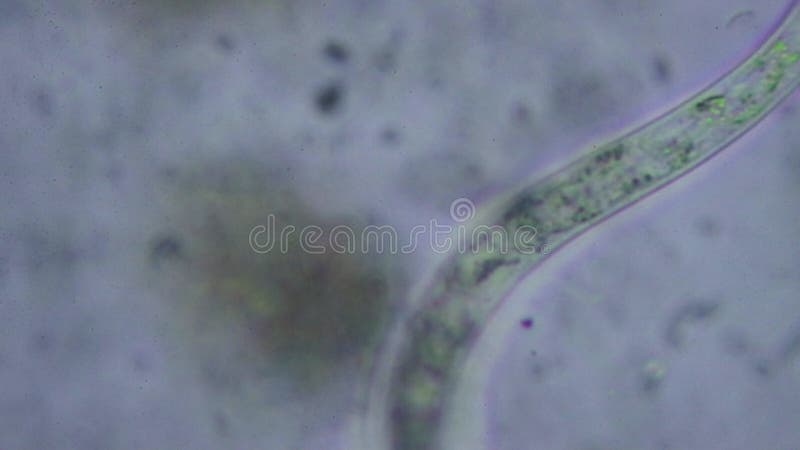 4k Footage of a Nematode Under a Microscope at Different Magnification ...