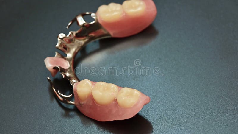 4K Partial Denture Upper Side on Black Background Stock Footage - Video ...