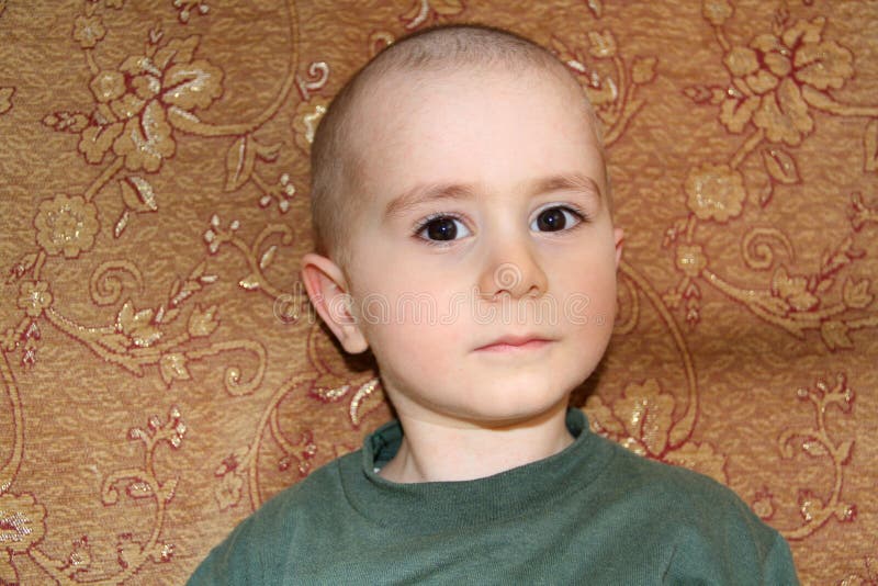 Portret Van Een Kale Jongen Stock Afbeelding - Image of zoon, kanker ...