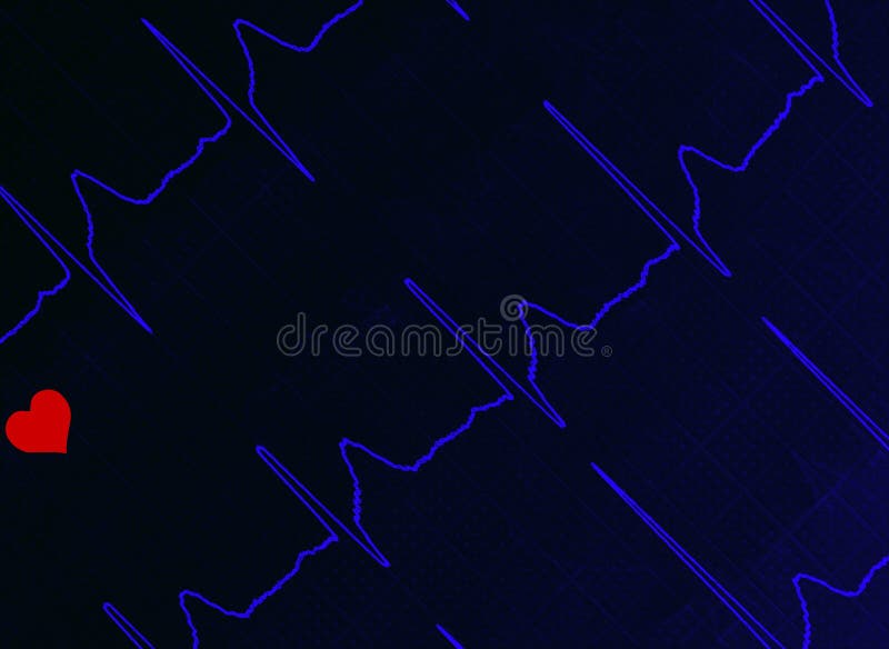 Kardiogramm Ekg Mit Dem Herzschlag Stock Abbildung - Illustration von ...