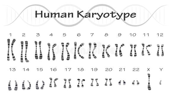 Vector Illustration Graphic of a Human Karyotype Stock Vector ...