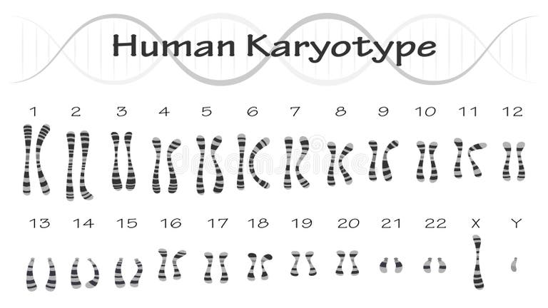 Vector Illustration Graphic of a Human Karyotype Stock Vector ...