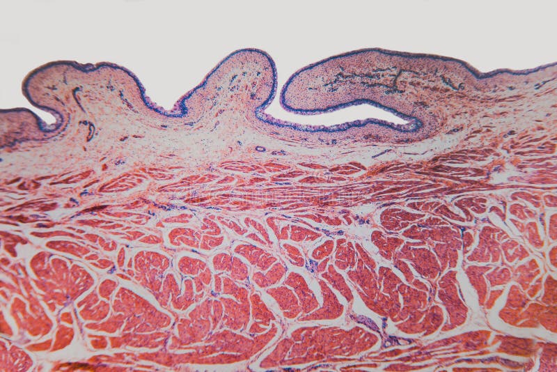 Kat Van De Cel De Microscopische Urineblaas Stock Foto - Image of nave ...