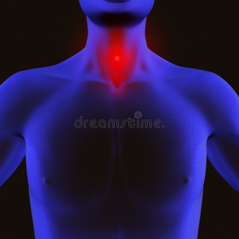 Keelpijnontsteking, Roodheid, Pijn Het Branden, Tablet En Zorg Stock ...