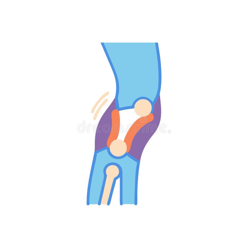 Key Features of Access Control Lists in Security Stock Illustration ...