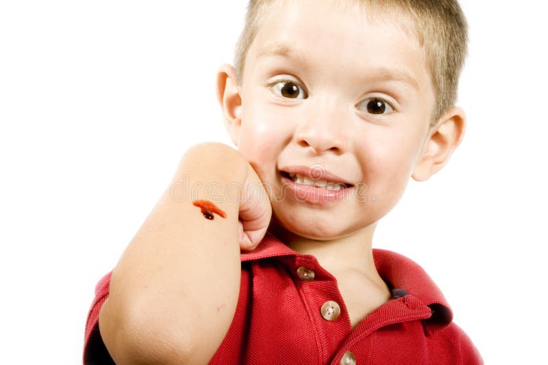 Kid with a boo-boo stock photo. Image of skin, scab, health - 9753618