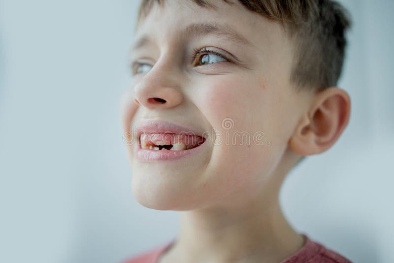 Kid Losing a Baby Tooth and a New Permanent Tooth Coming Out Stock ...