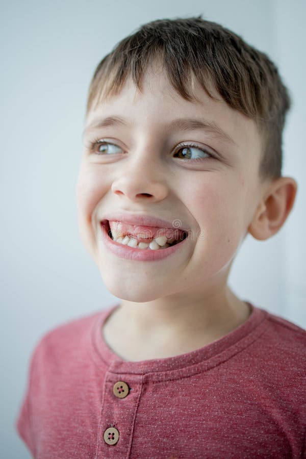 Kid Losing a Baby Tooth and a New Permanent Tooth Coming Out Stock ...
