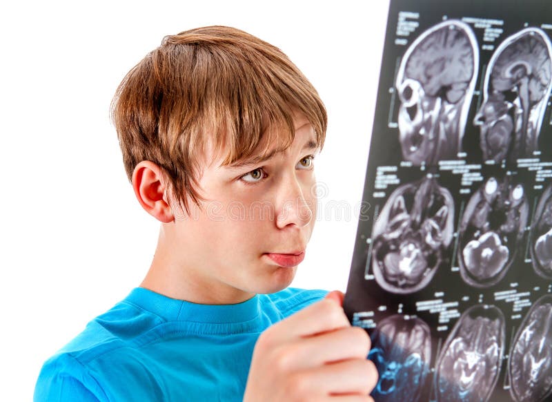 Kid with X-Ray stock image. Image of looking, holding - 84598695