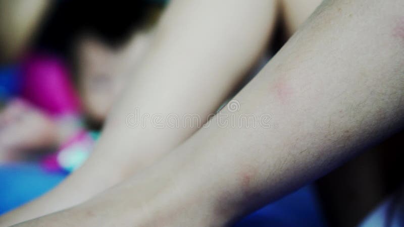 Kid scratch the itchy leg stock video. Video of lifestyles - 260115213