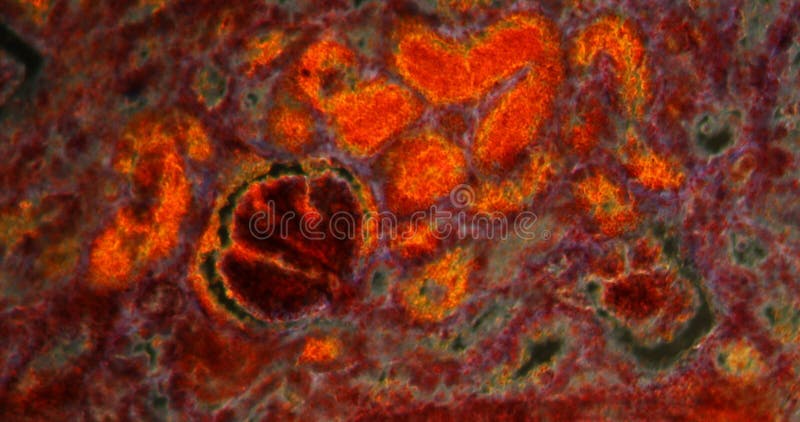 Kidney Bleeding in Darkfield Stock Video - Video of macro, research ...