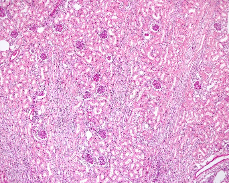 Kidney Cortex. Medullary Rays Stock Illustration - Illustration of ...