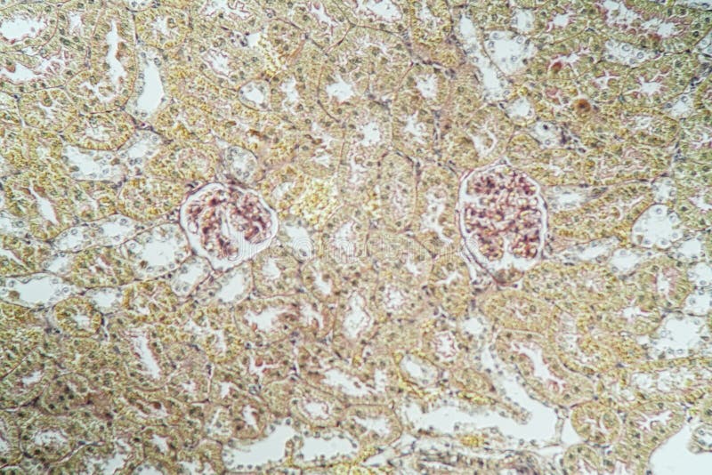 Kidney Cortex Under the Microscope Stock Photo - Image of small, tiny ...