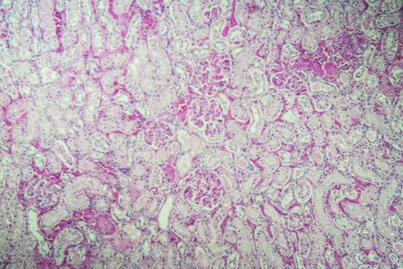 Kidney Cortex Under the Microscope Stock Photo - Image of tissue ...