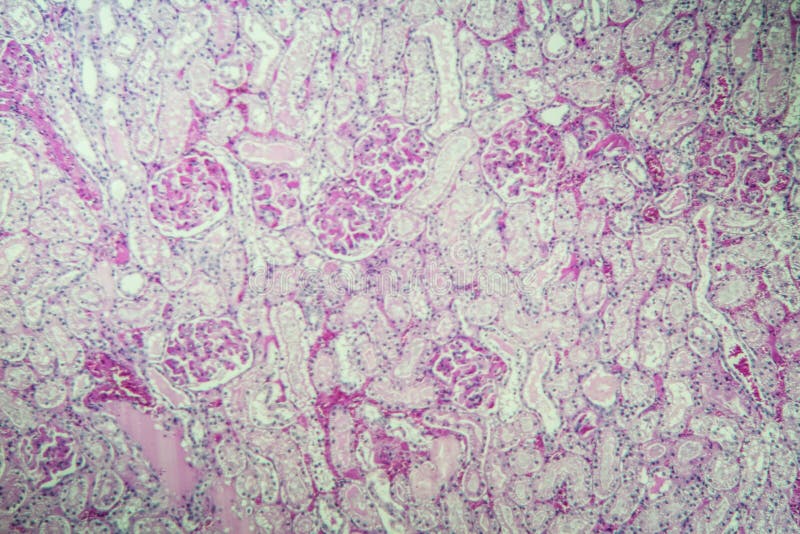 Kidney Cortex Under the Microscope Stock Image - Image of enlargement ...