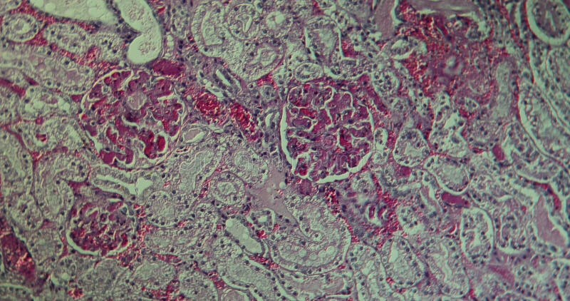 Kidney with Glomeruli and Baumanscher Capsule Stock Footage - Video of ...