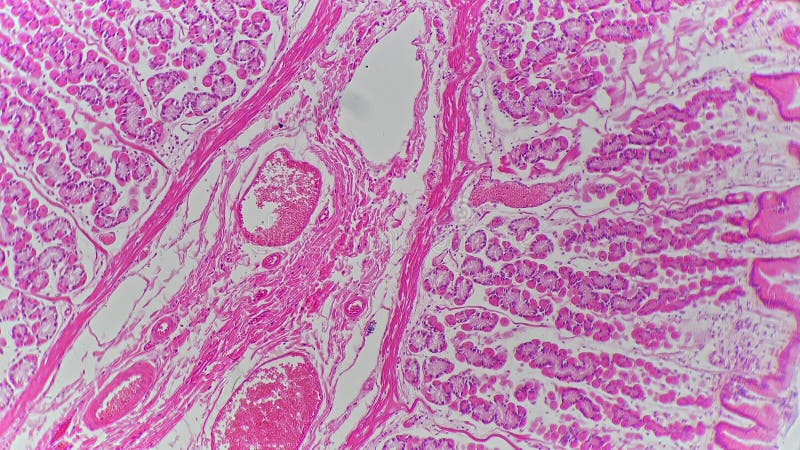 Human Kidney with Blood Vessel Injected in Section Filmed Under ...