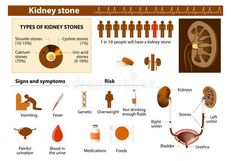 Kidney Stock Illustrations – 43,682 Kidney Stock Illustrations, Vectors ...