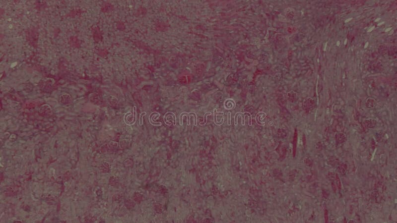 Kidney tissue in close up stock footage. Video of microscopy - 345125940