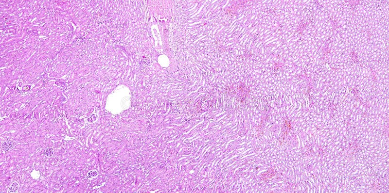 Kidney tissue of a human stock image. Image of micro - 97906017