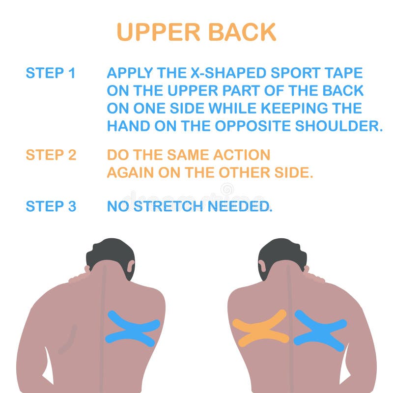 Kinesiology Taping for Upper Back. Correct Kinesiology Taping Stock ...