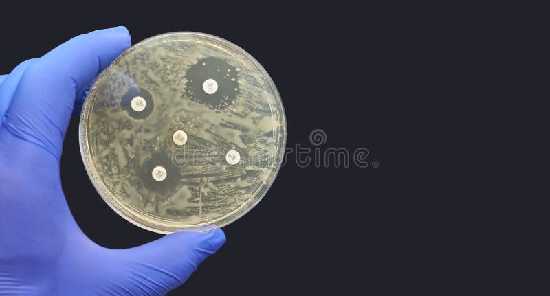 Kirby-Bauer Disk Diffusion Antimicrobial Susceptibility Test Black ...
