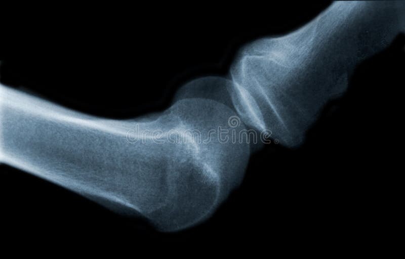 Knee stock image. Image of anatomy, white, joint, medicine - 4887359