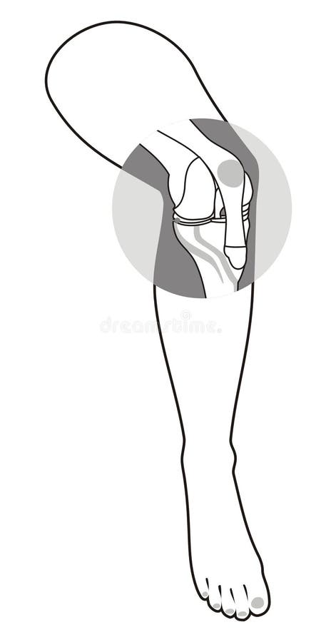 Kneecap Bone Stock Illustrations – 531 Kneecap Bone Stock Illustrations ...