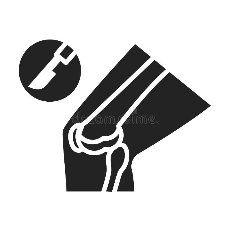 Knee Disease Black Glyph Icon. Total Knee Replacement Surgery Stock ...